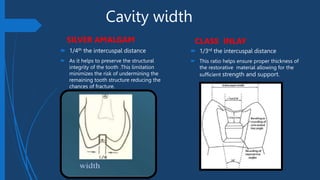 Differences-Between-Cast-Restoration-and-Amalgam[1].pptx