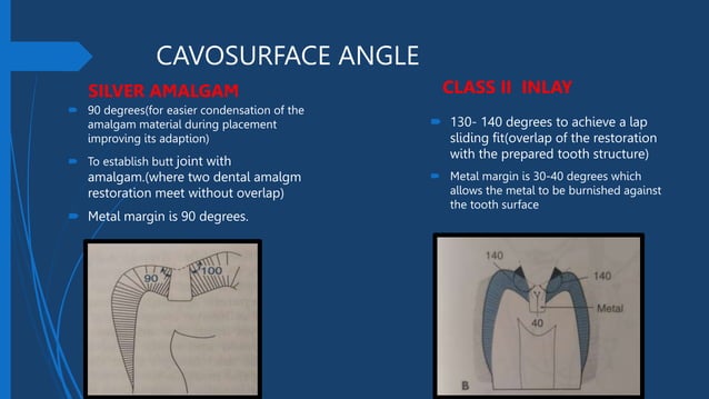 Differences-Between-Cast-Restoration-and-Amalgam[1].pptx