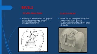 Differences-Between-Cast-Restoration-and-Amalgam[1].pptx