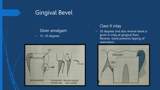Differences-Between-Cast-Restoration-and-Amalgam[1].pptx