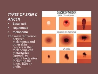 винод 413 skin cancer.pptx | Skin and Dermatology | Diseases and Conditions
