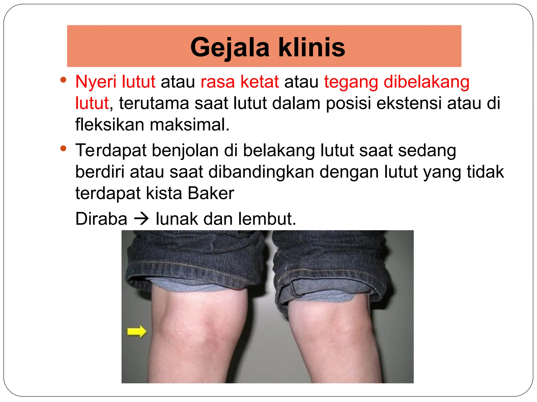 414563162-Baker-Cystaaaaa-Powerpoint.ppt