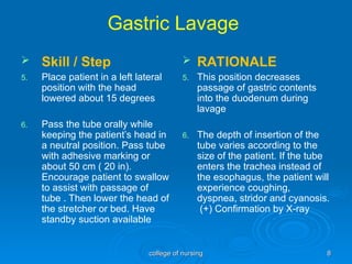 414594447-7352949-NGT-Lavage- by 1-ppt.ppt