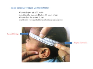 Growth assessment and monitoring | PDF