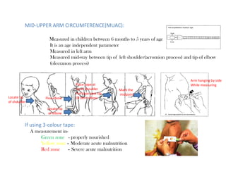 Growth assessment and monitoring | PDF