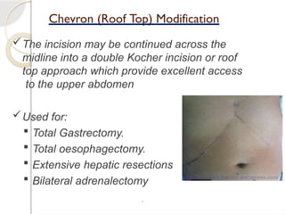 415148561-PT-in-Abdominal-Surgery physiotherapy | PPTX
