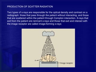 About of X-Ray generation and its radiation | PPT