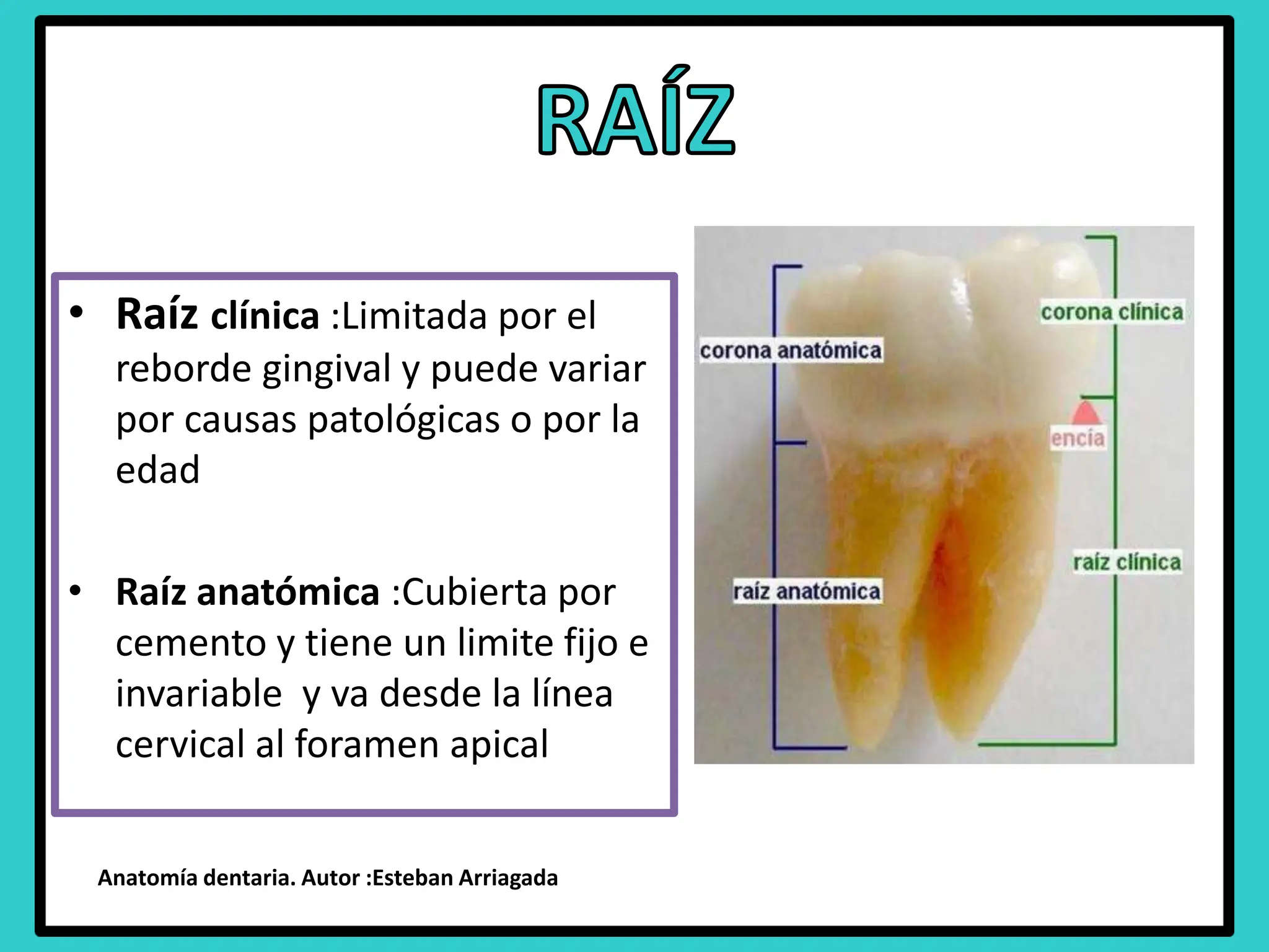 ANATOMIA DENTAL CORONA CUELLO Y RAIZ DENTAL | PPTX