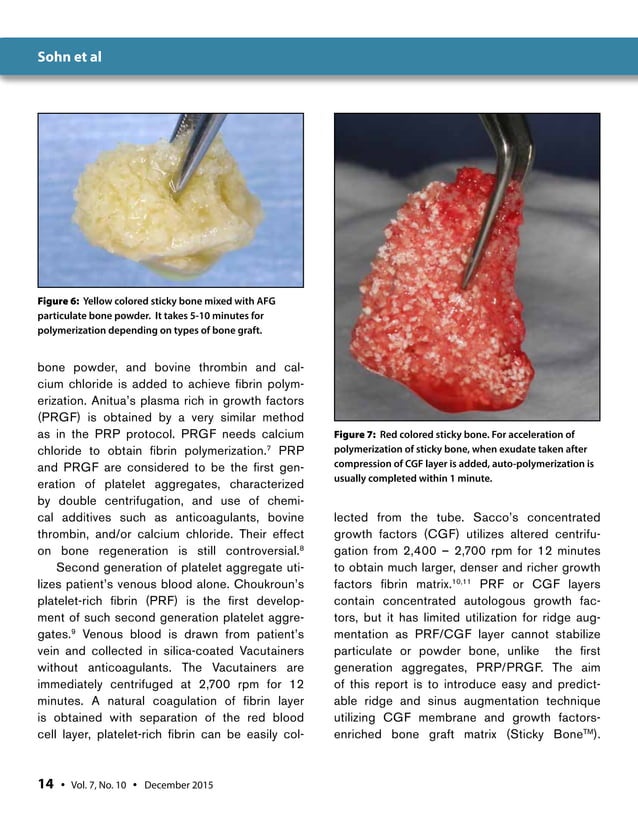 2015 Dec JIACD_Sticky Bone_Sohn et al | PDF