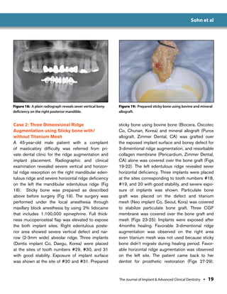 2015 Dec JIACD_Sticky Bone_Sohn et al | PDF