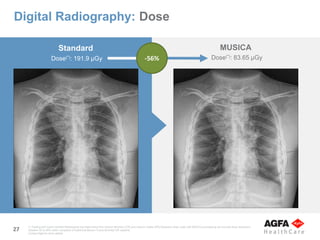 Introducing Agfa HealthCare v1.28