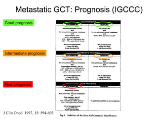 ECCLU 2011 - K. Fizazi - Testicular cancer - Treatment of advanced ...
