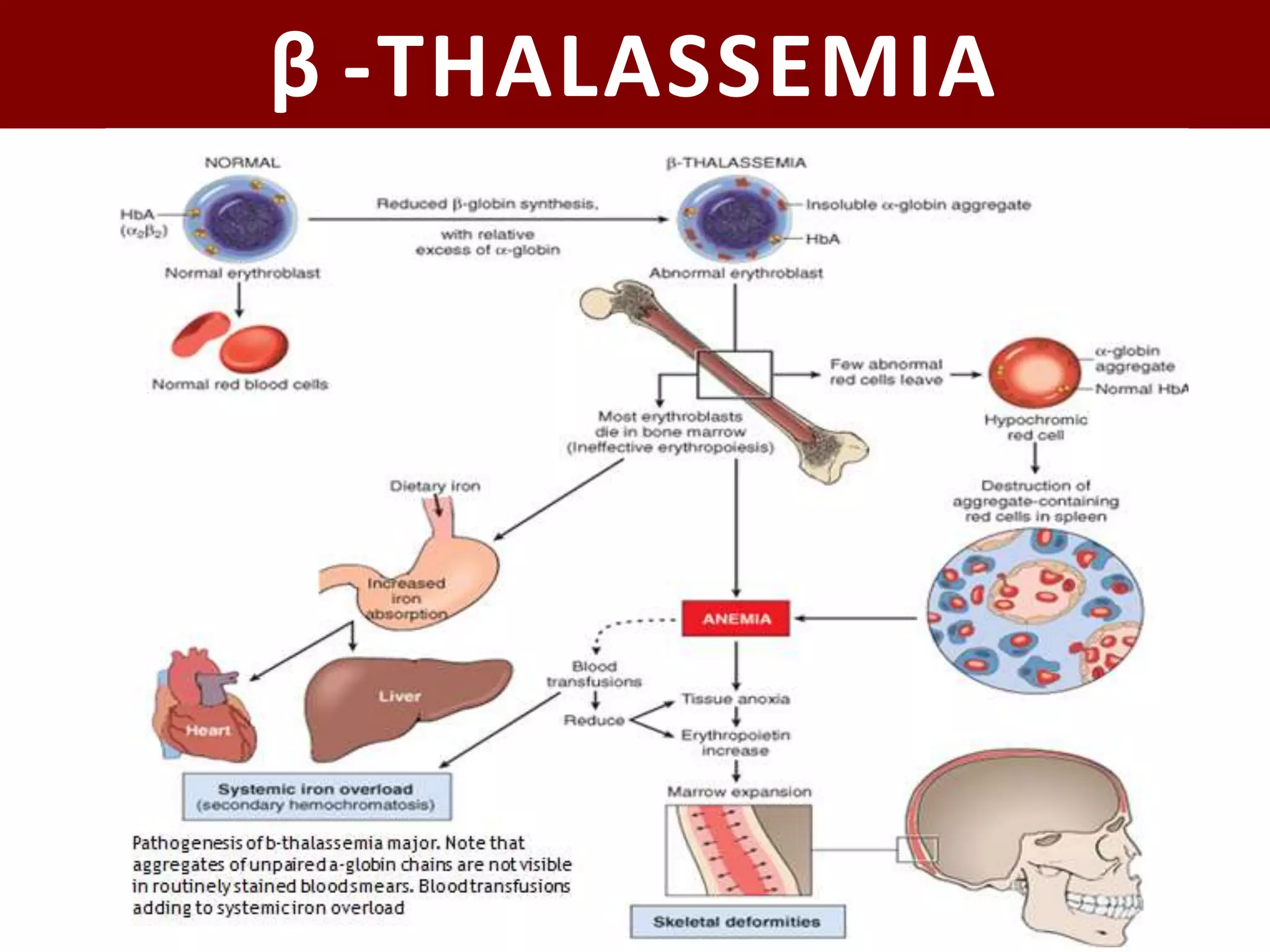 Management of Thalassemia | PPTX
