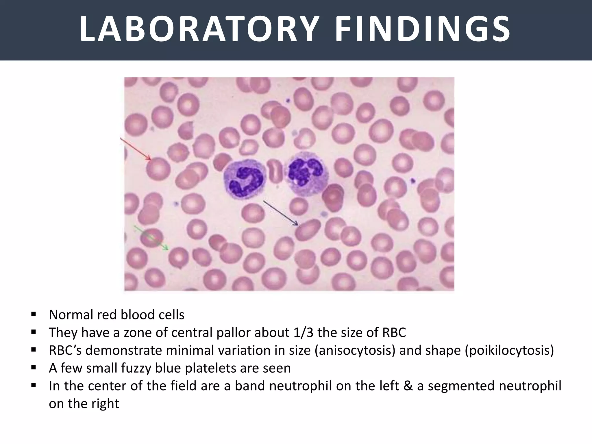 Management of Thalassemia | PPTX