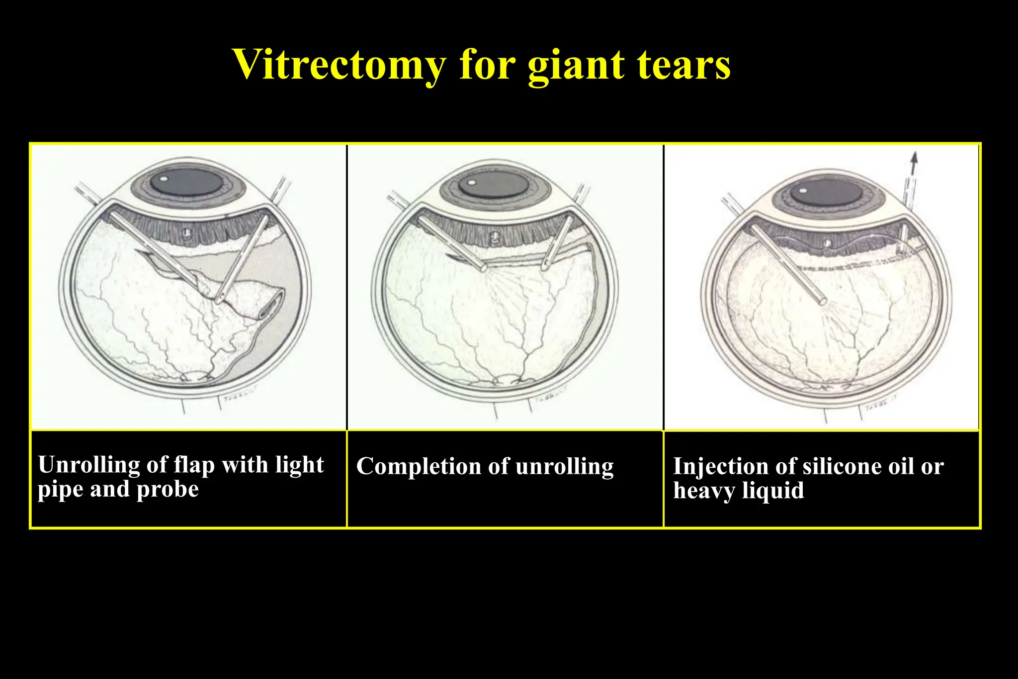 Principles RD Surgery.ppt