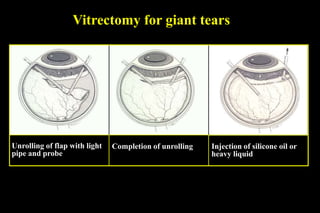 Principles RD Surgery.ppt