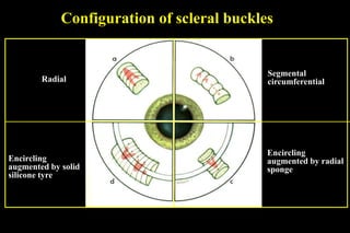 Principles RD Surgery.ppt