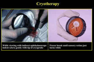 Principles RD Surgery.ppt