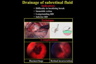 Principles RD Surgery.ppt