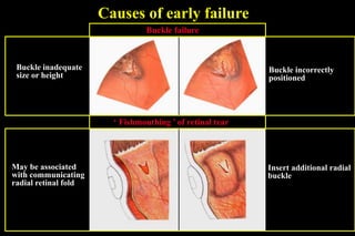 Principles RD Surgery.ppt