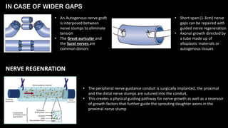 CLASSIFICATION OF NERVE INJURIES | PPTX
