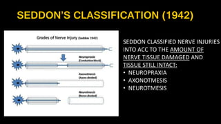 CLASSIFICATION OF NERVE INJURIES | PPT