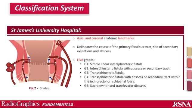 Perianal fistula and Abscess.pptx | Digestive Disorders | Diseases and ...