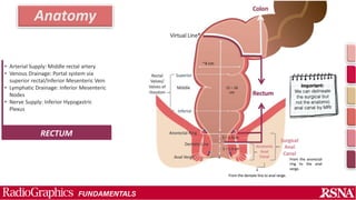 Perianal fistula and Abscess.pptx
