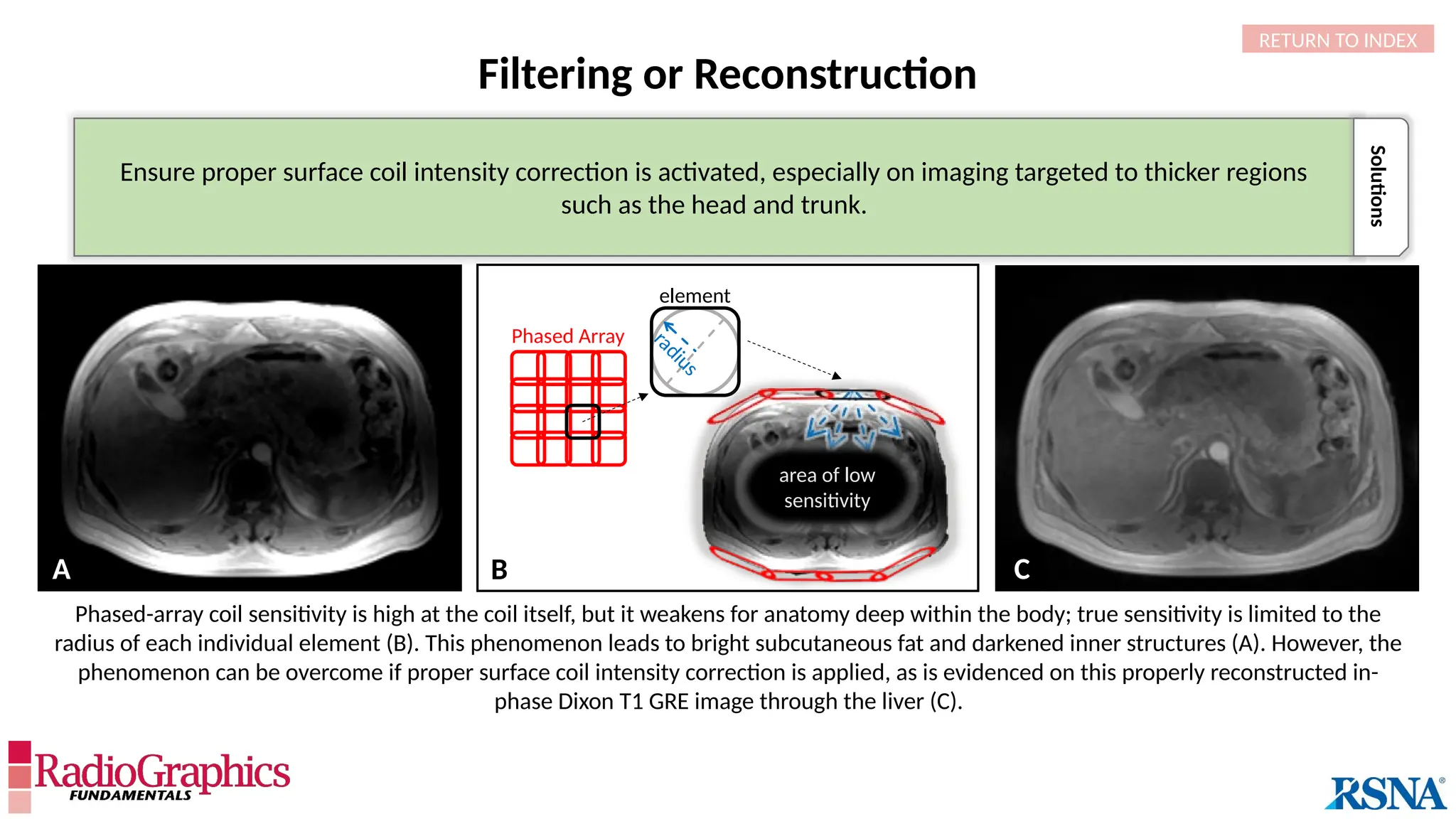 A primer on magnetic resonance imaging artifacts | PPTX