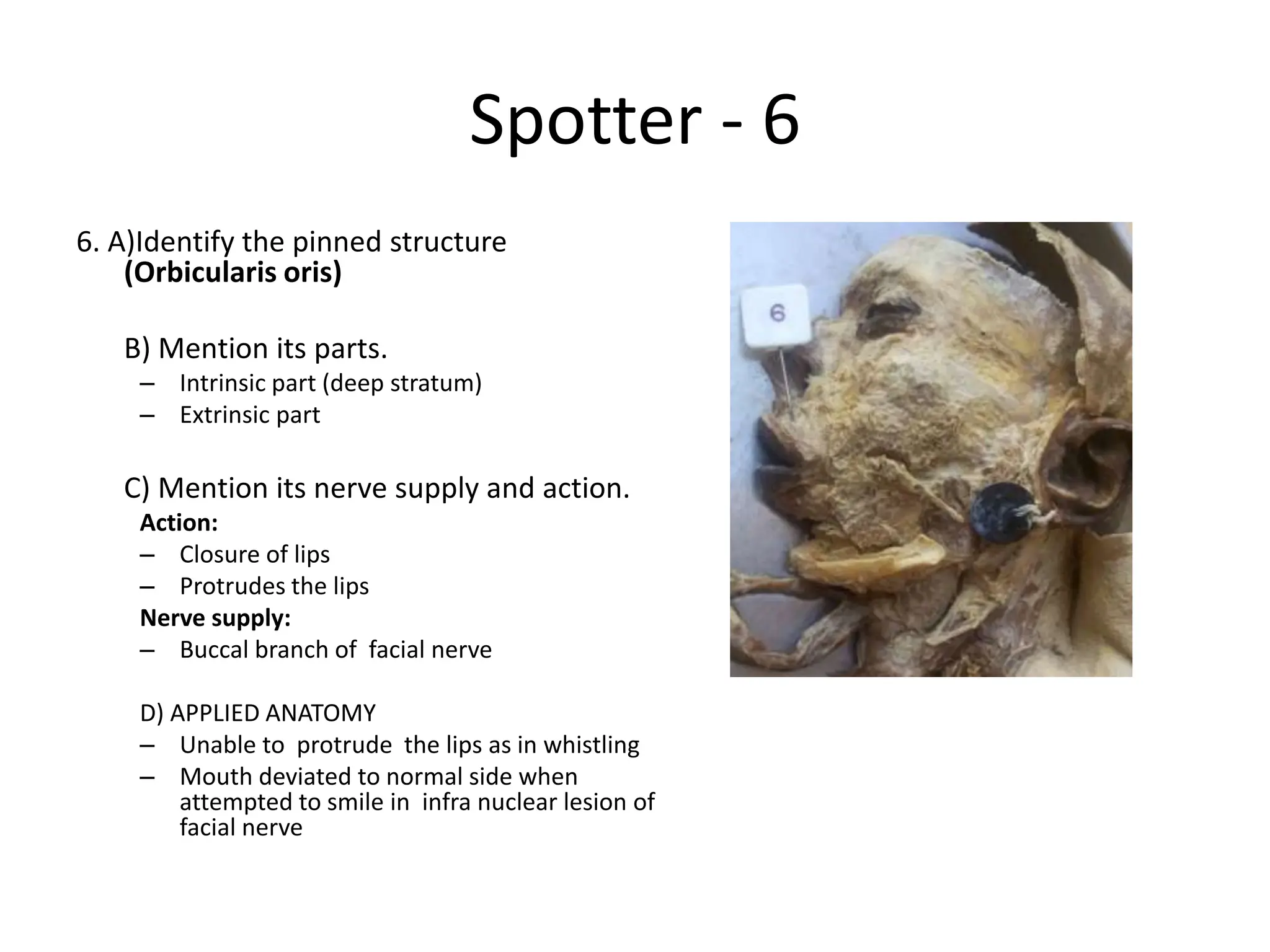 420559379-Head-Neck-Spotters-Final-With-Answers-1 (1).pptx