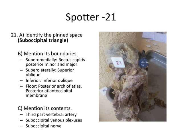 420559379-Head-Neck-Spotters-Final-With-Answers-1 (1).pptx | Death, Injury, or Military Conflict ...