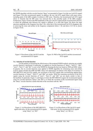Artifact elimination in ECG signal using wavelet transform | PDF