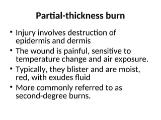 Pediatric burn is the leading cause of death in children - | PPT