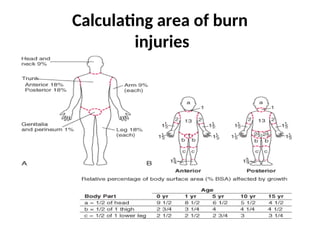 Pediatric burn is the leading cause of death in children - | PPT
