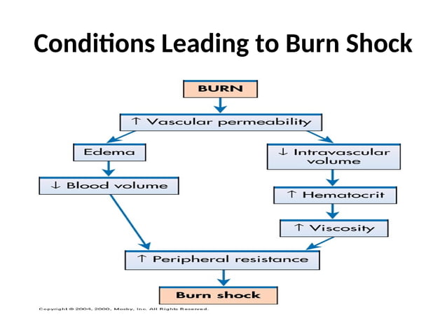 Pediatric burn is the leading cause of death in children - | PPT