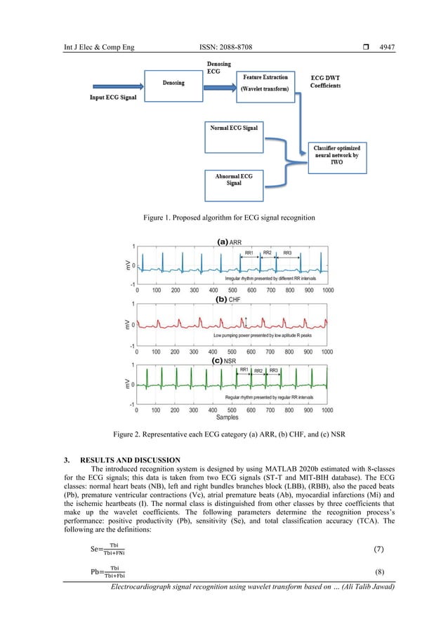 Electrocardiograph Signal Recognition Using Wavelet Transform Based On Optimized Neural Network