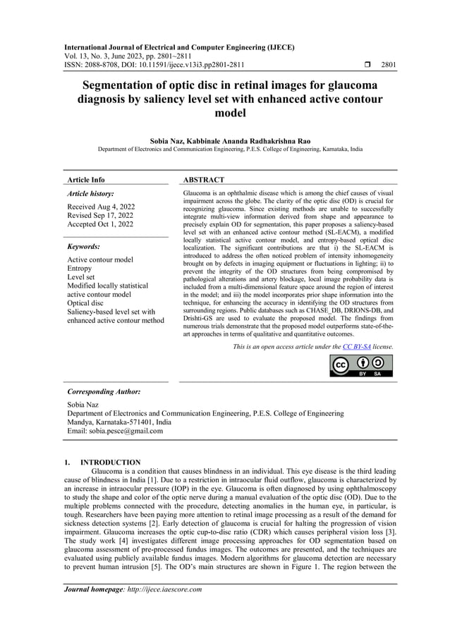 Segmentation of optic disc in retinal images for glaucoma diagnosis by saliency level set with ...