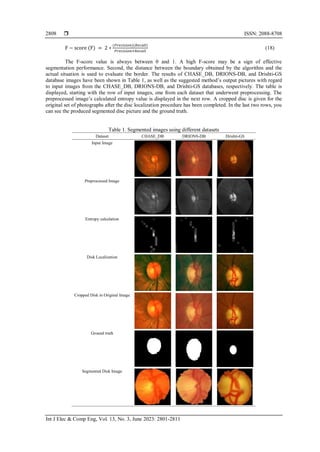Segmentation of optic disc in retinal images for glaucoma diagnosis by saliency level set with ...