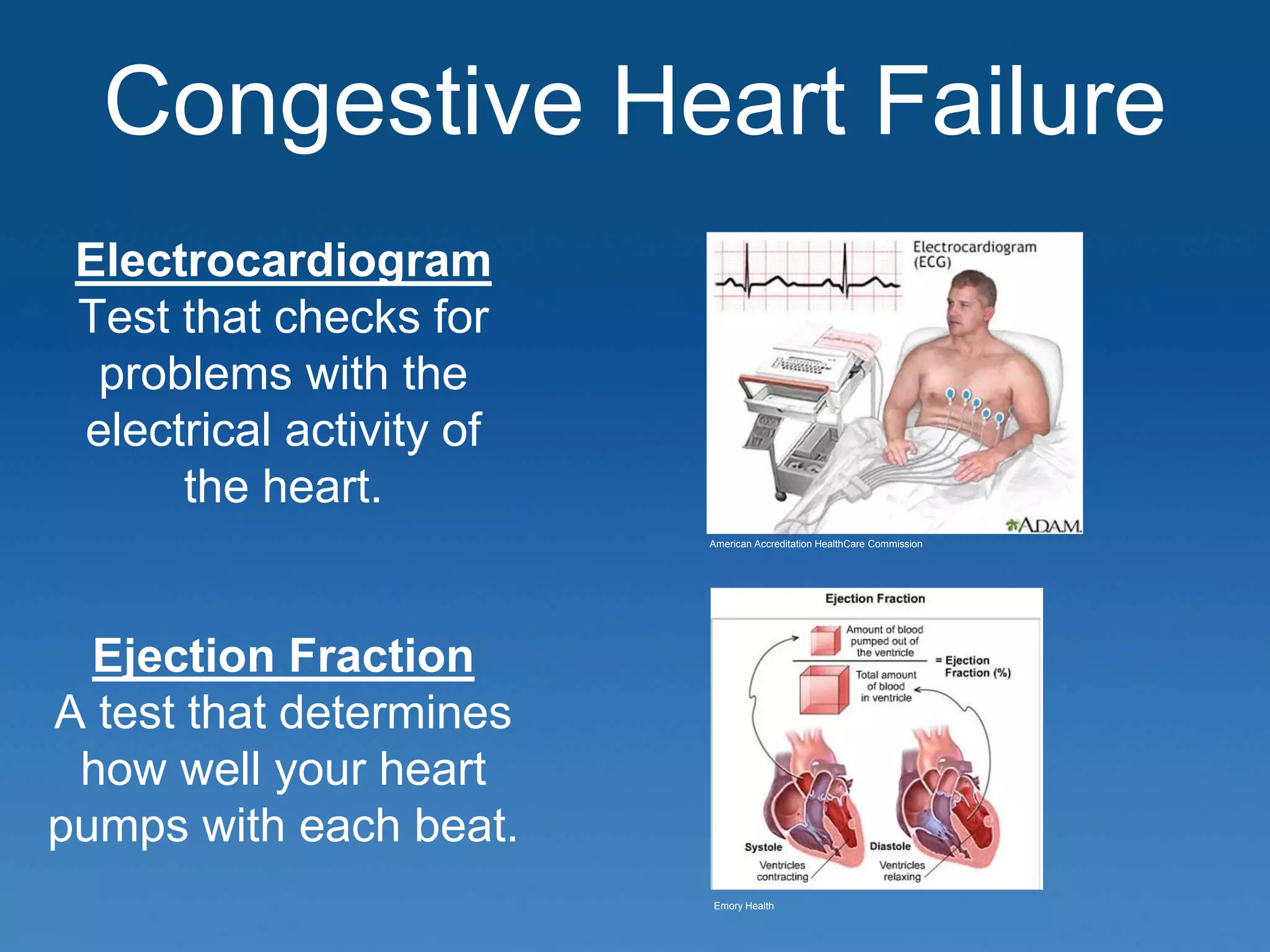 Congestive Heart Failure Case Study | PPTX