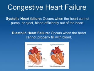 Congestive Heart Failure Case Study | PPTX