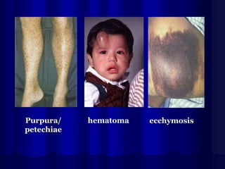 4_242261092074520904.ppt