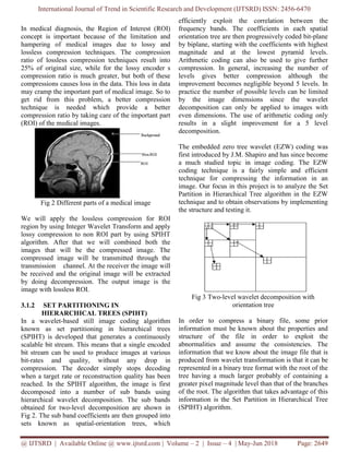 Implementation of Brain Tumor Extraction Application from MRI Image | PDF
