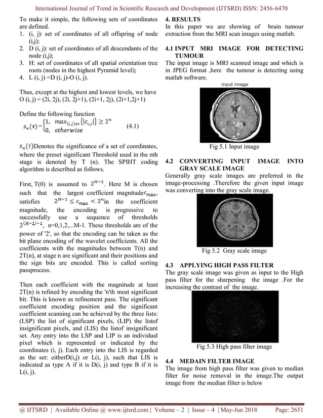 Implementation of Brain Tumor Extraction Application from MRI Image | PDF