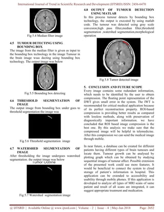 Implementation of Brain Tumor Extraction Application from MRI Image | PDF