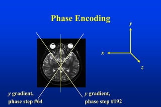 Principles of MRI Physics and Engineering.ppt