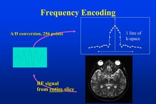 Principles of MRI Physics and Engineering.ppt