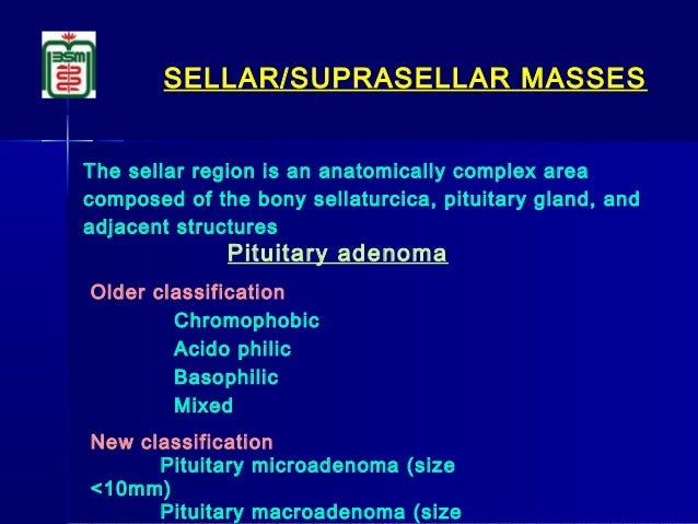 42925901 brain-tumor