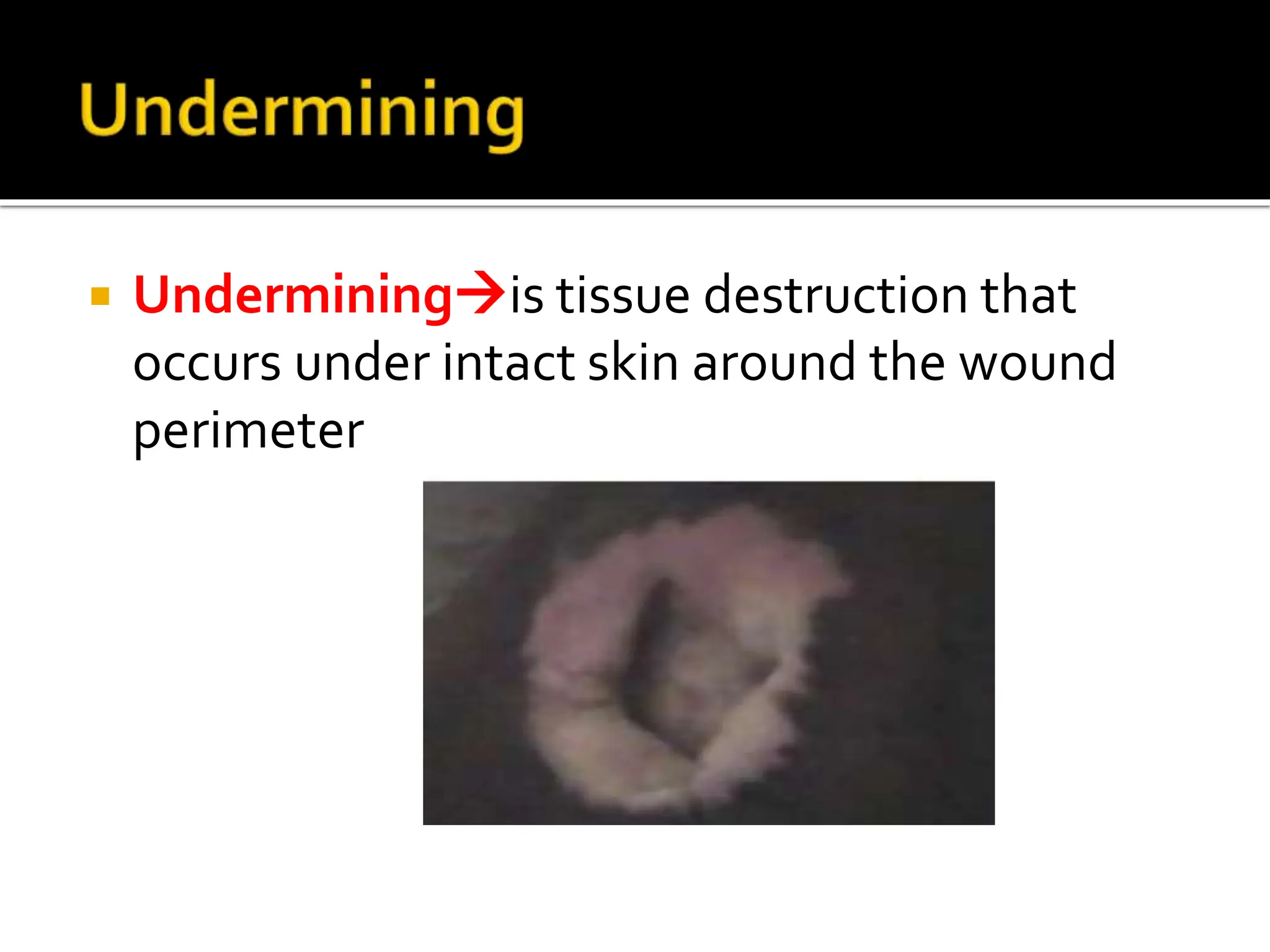 42954304112229-WOUND-assessment-1-ppt.ppt