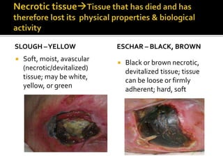 42954304112229-WOUND-assessment-1-ppt.ppt