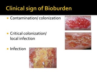 42954304112229-WOUND-assessment-1-ppt.ppt